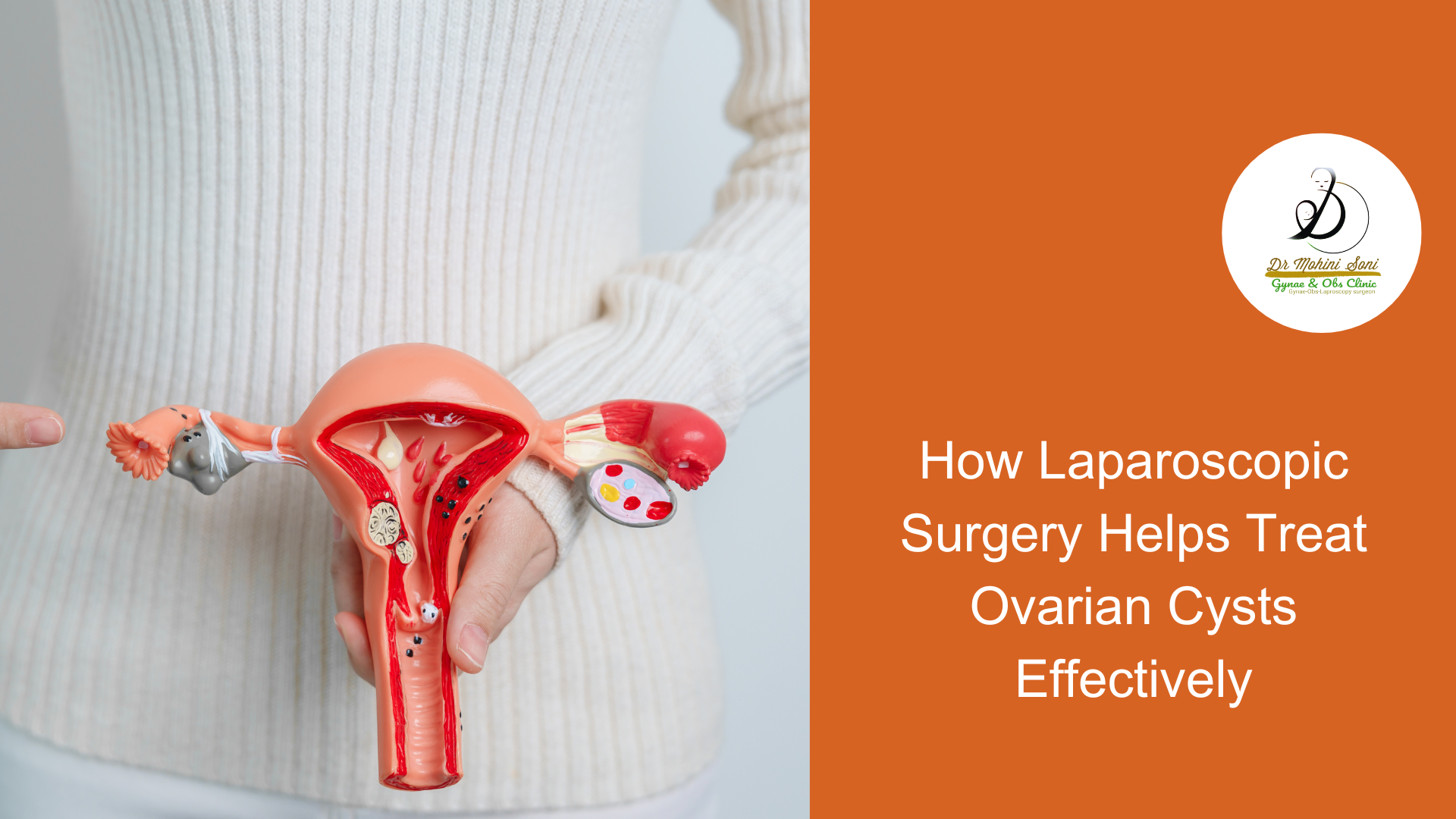 How Laparoscopic Surgery Helps Treat Ovarian Cysts Effectively ...