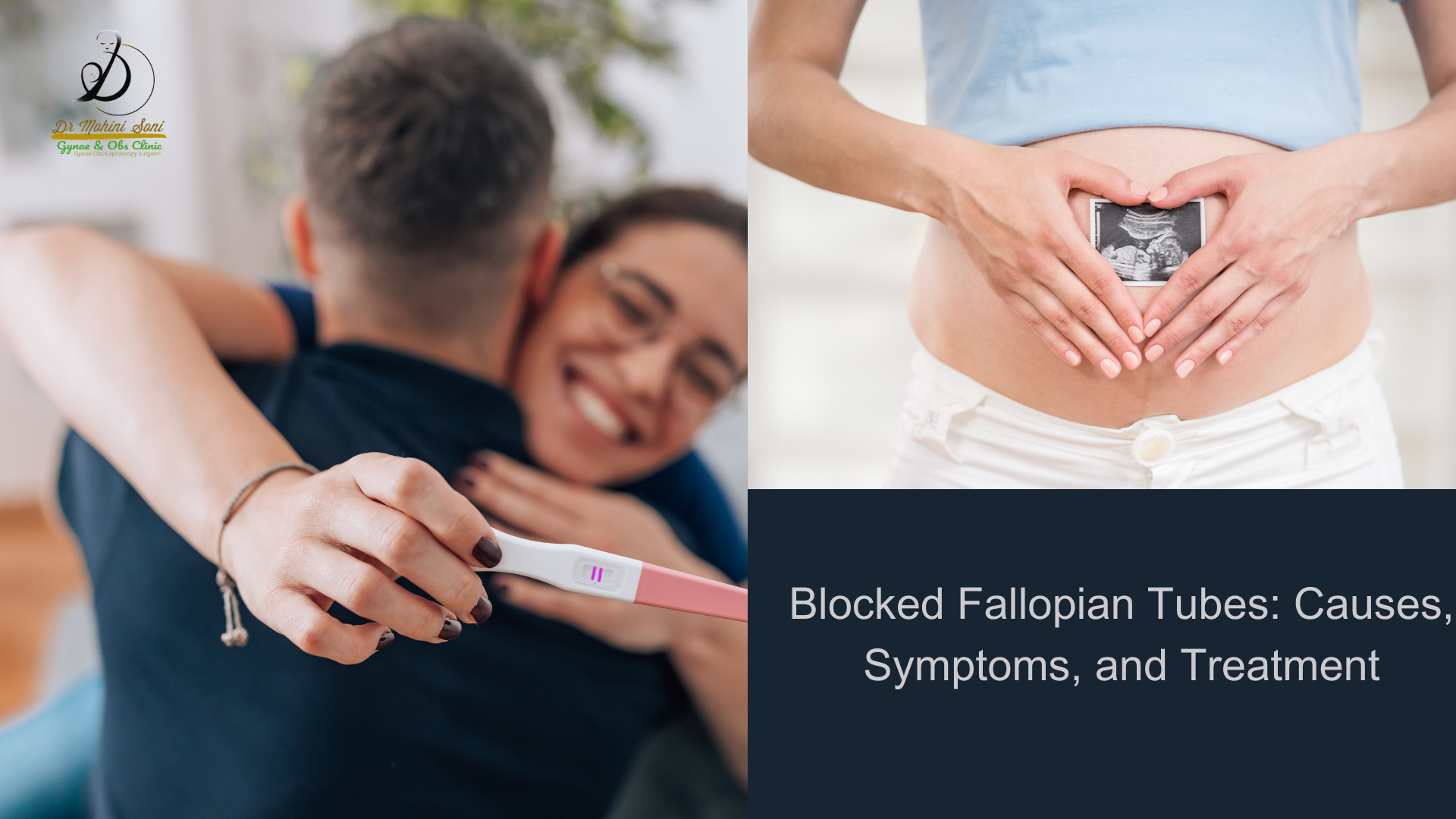 Blocked Fallopian Tubes: Causes, Symptoms, and Treatment -gynecologist ...